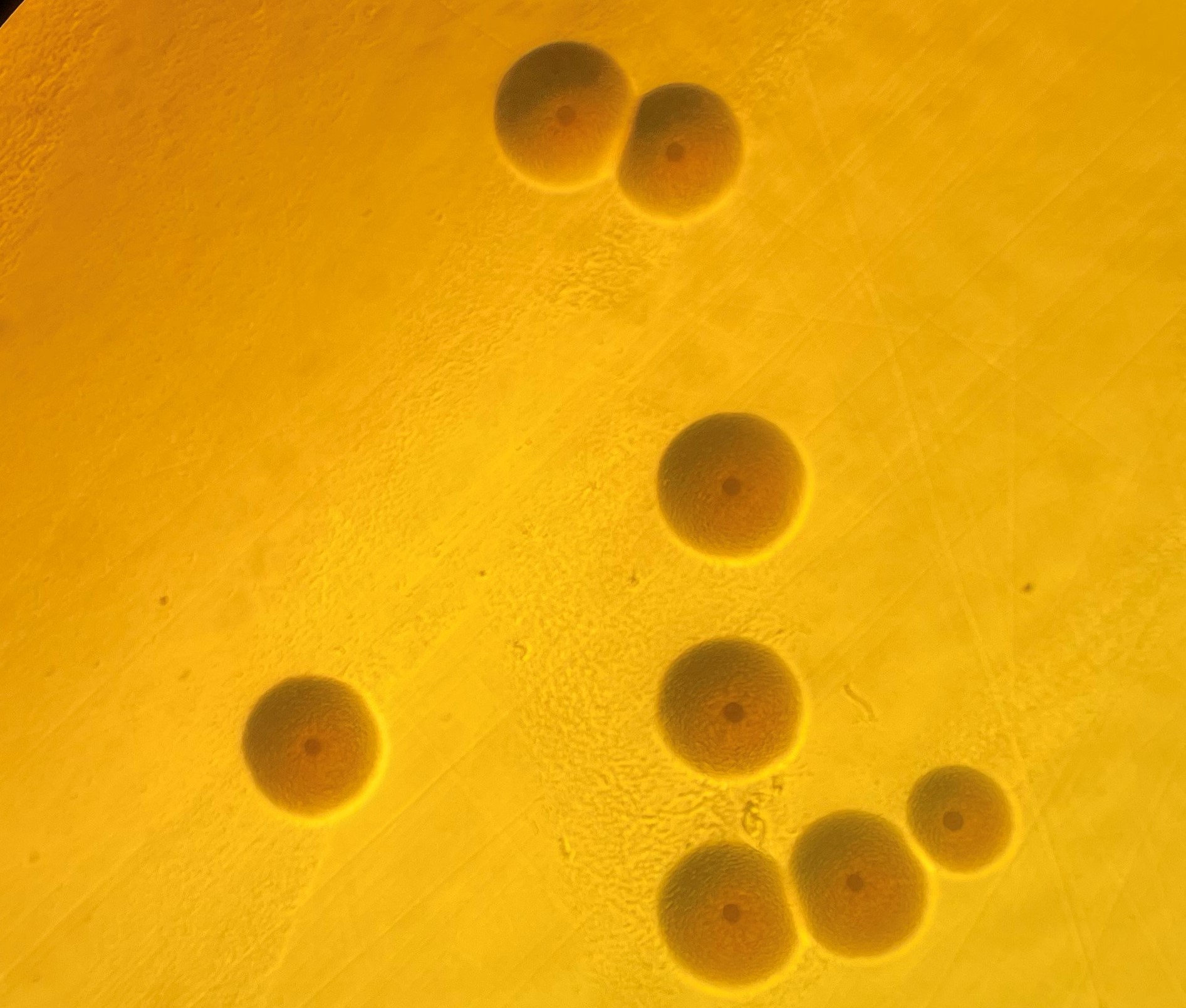 Researchers discovered a new bacteria